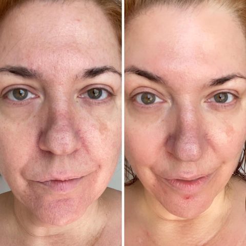 Infuse HA is Here! - Beauty Society