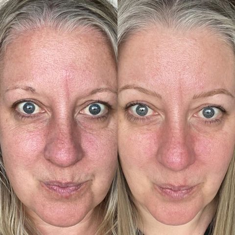 Infuse HA is Here! - Beauty Society